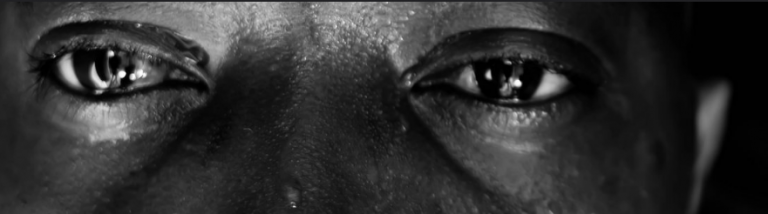 What is Diaphoresis and excessive diaphoresis? - Types, Causes and ...